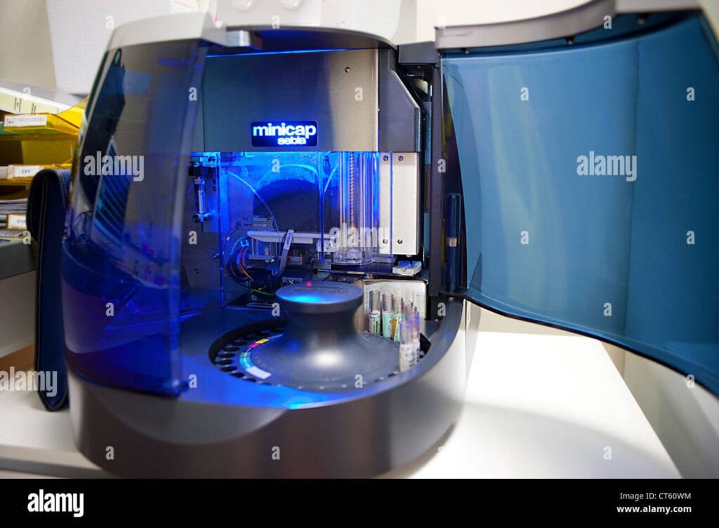 Sebia Minicap Automated Capillary Electrophoresis System - rosemedicare.com