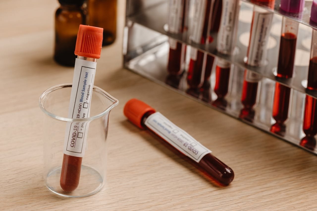 Understanding Blood Tubes and Their Different Types - rosemedicare.com